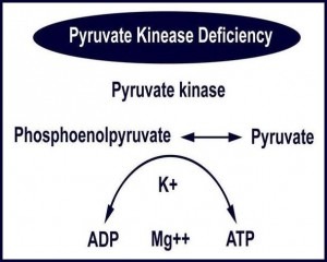 Pyruvate Kinase Deficiency - Ask Hematologist | Understand Hematology