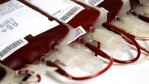 Blood Cells - Ask Hematologist | Understand Hematology