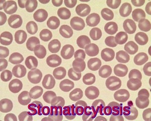 Ask Hematologist | Understand Hematology